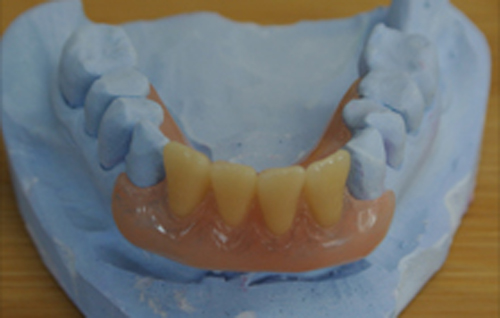 Prothèse Nylon Deflex Emcolab Dental